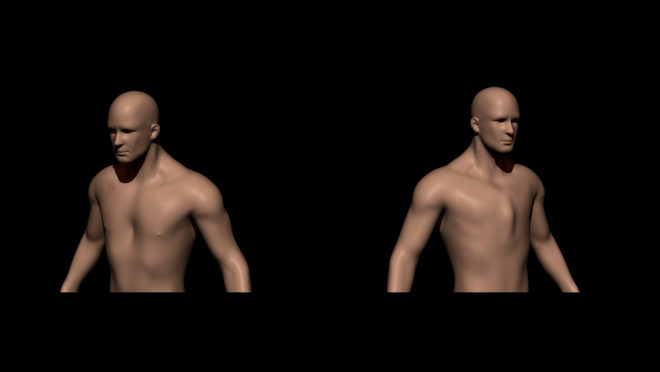 Pectus excavatum e pectus carinatum, o que é e como tratar?