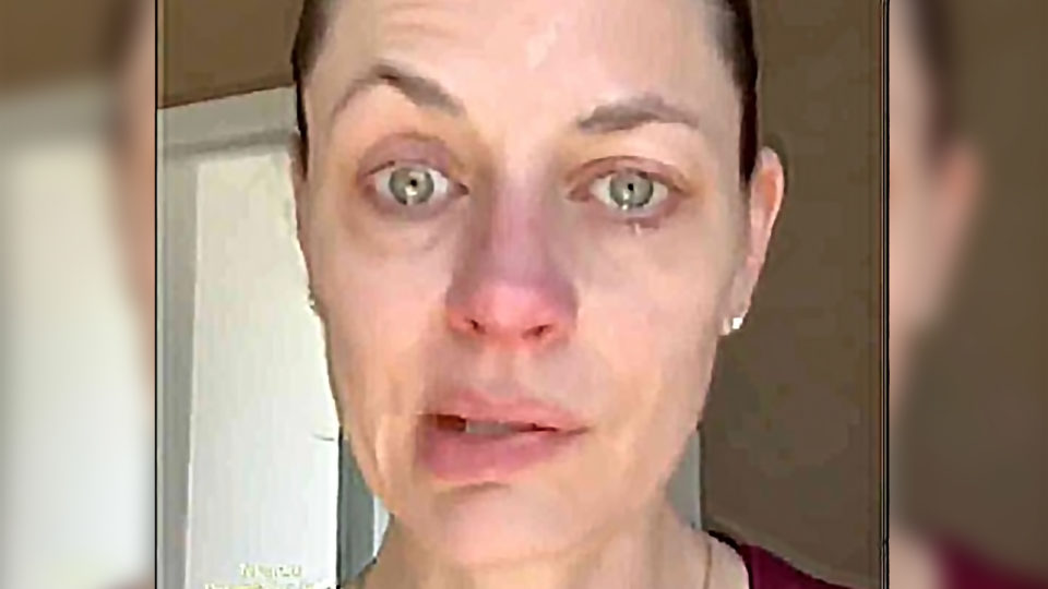 Vacinas contra Covid-19 dobram o risco de Paralisia de Bell