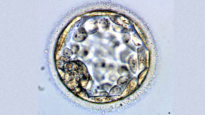 Criação de embriões humanos “sintéticos” desafia padrão ético mundial