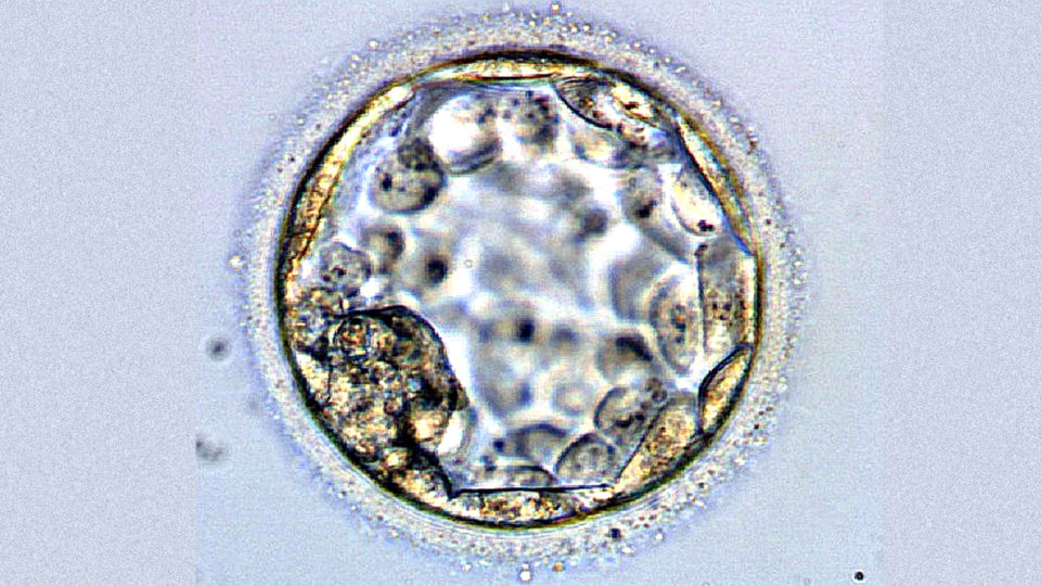 Criação de embriões humanos “sintéticos” desafia padrão ético mundial