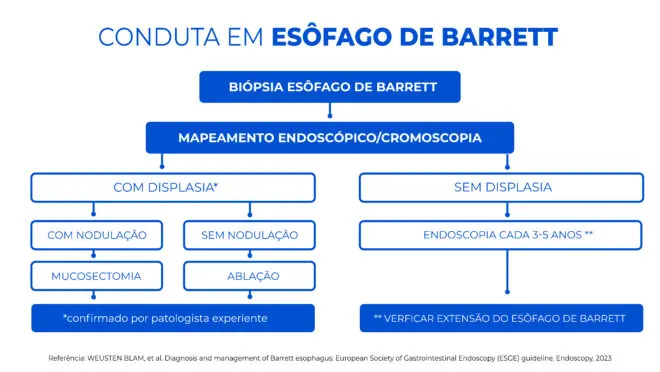 Esôfago de Barrett: diagnóstico, riscos e como tratar
